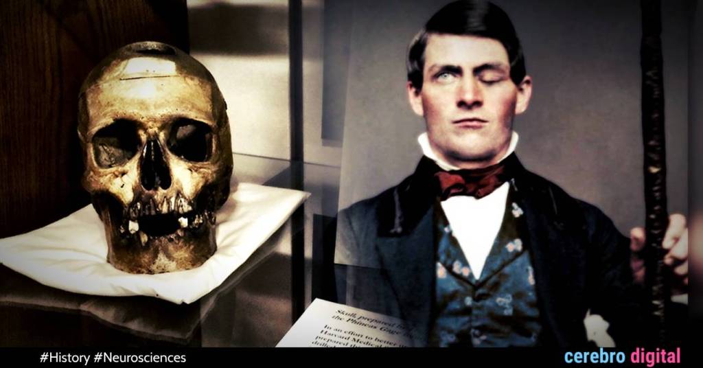Phineas Gage: How did he survive a destroyed frontal lobe?