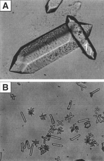 Crean una insulina inteligente que se activa según los niveles de glucosa