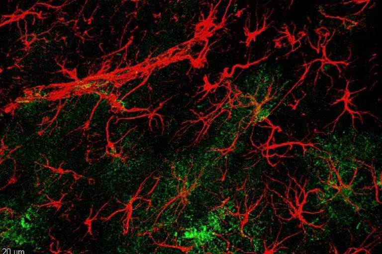 Descubren una molécula natural capaz de revertir el deterioro cognitivo