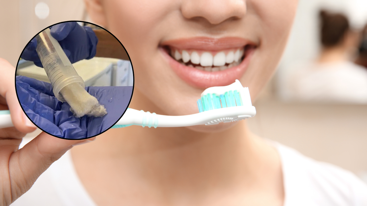 El Signo de Frank: ¿Un detector de infartos?