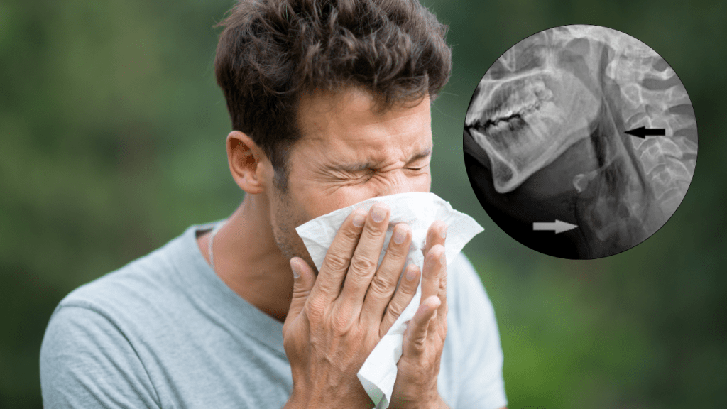 El Signo de Frank: ¿Un detector de infartos?